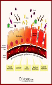 Leaky Gut and Inflammation | Causes, Symptoms, and Solutions